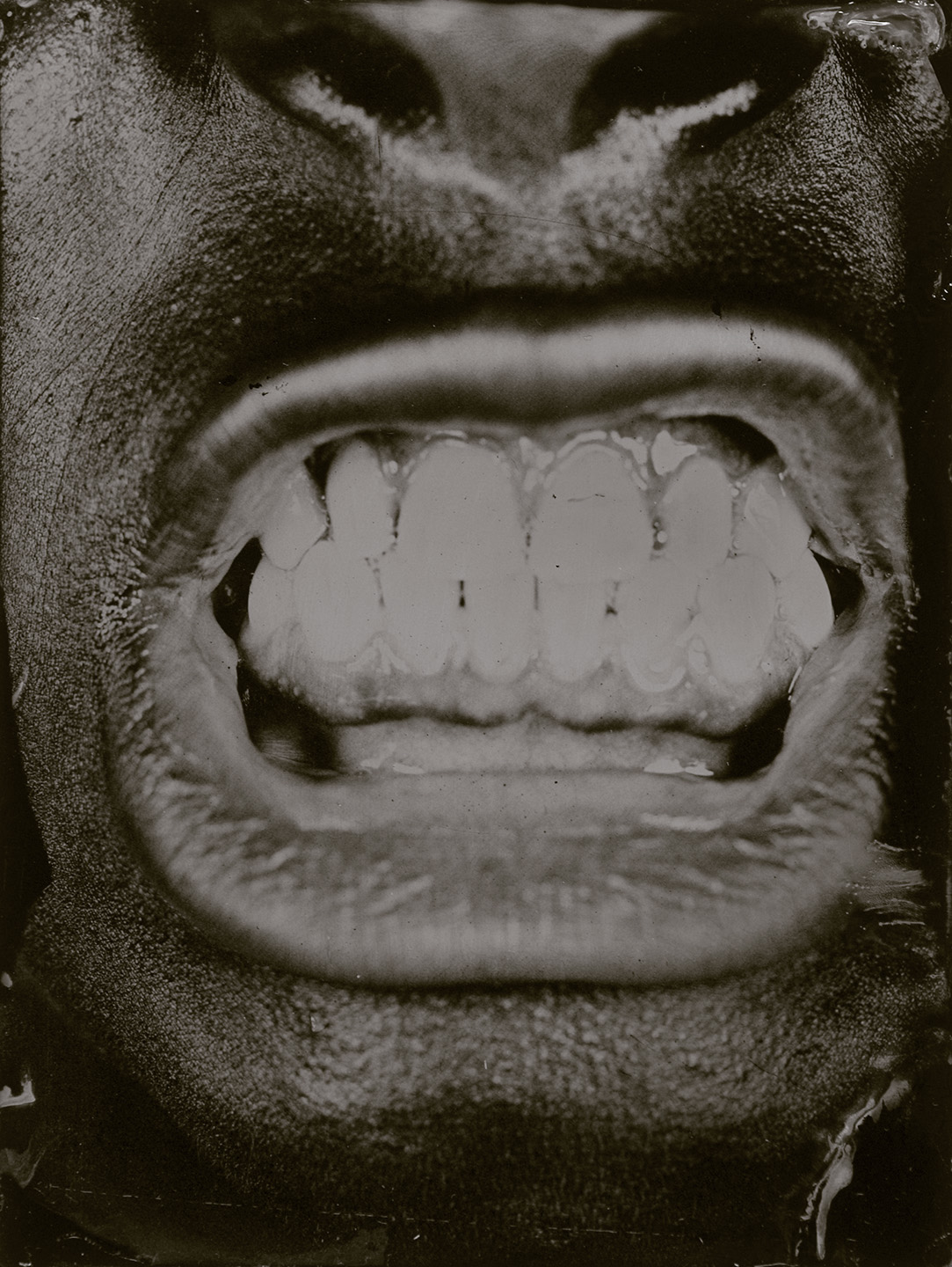 Character Recognition